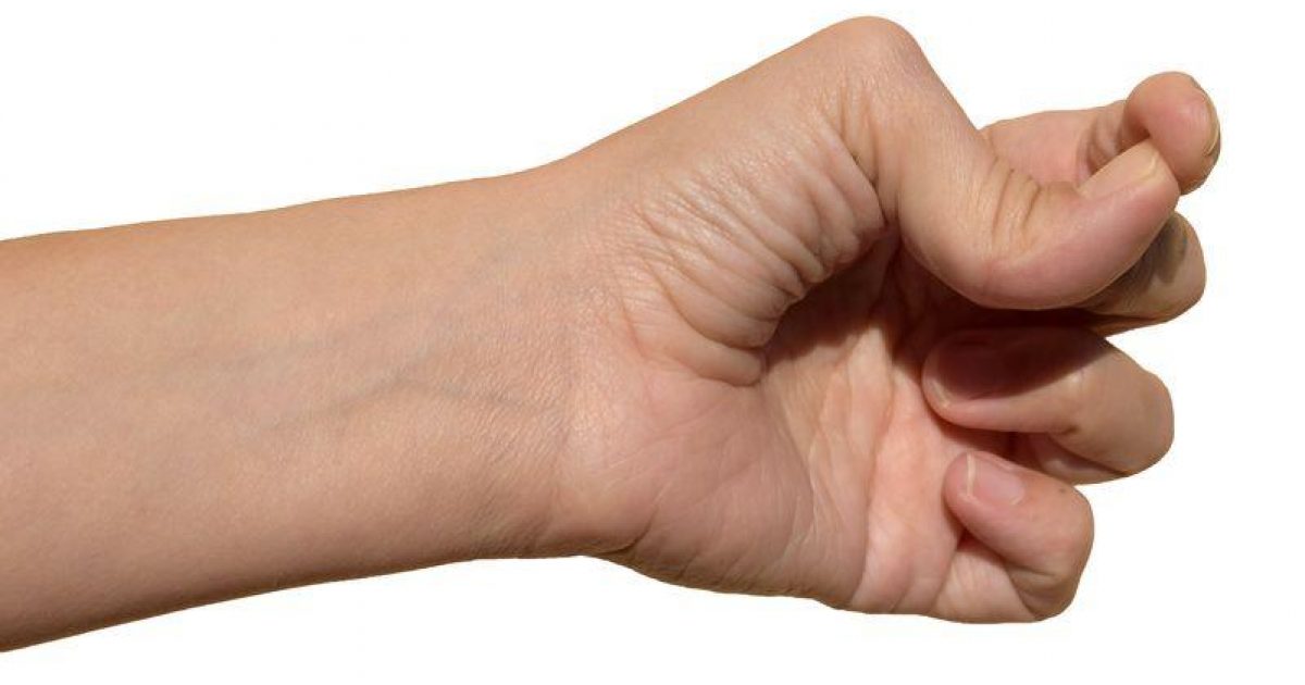 Hyper-Mobility Syndromes tips | Counseling | Therapy